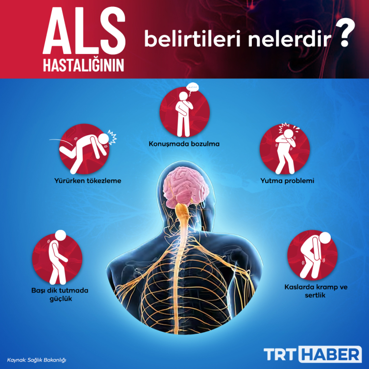 ALS’de erken teşhis fazlasıyla önemli - Son Dakika Haberleri