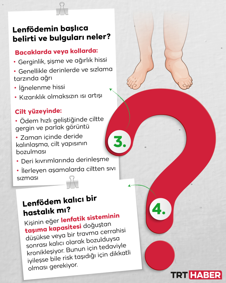 Lenfödem tedavi sonrası da dikkat gerektiren bir hastalık - Son Dakika ...